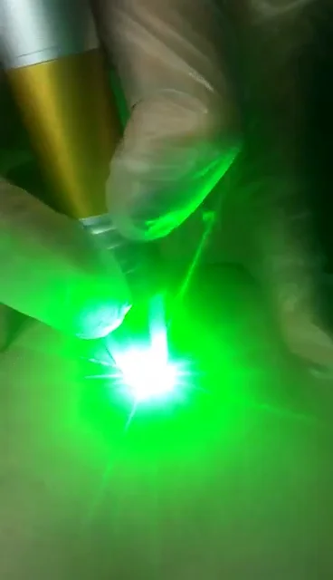 Diode 532nm Ktp Vascular Laser Nd Yag Ktp Laser For Vascular Removal ...