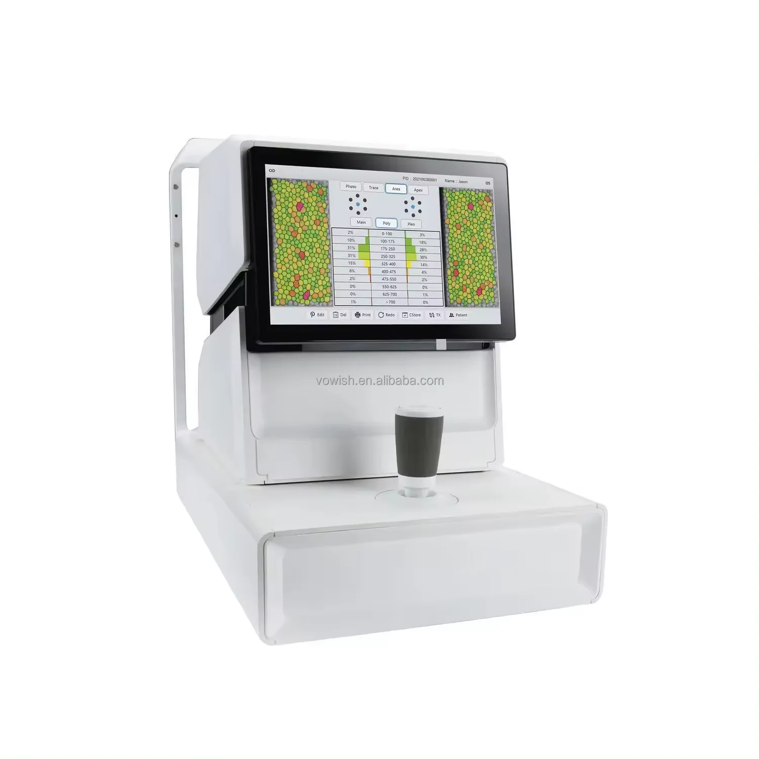 Vowish Corneal Specular Microscope - Precision & Custom Support