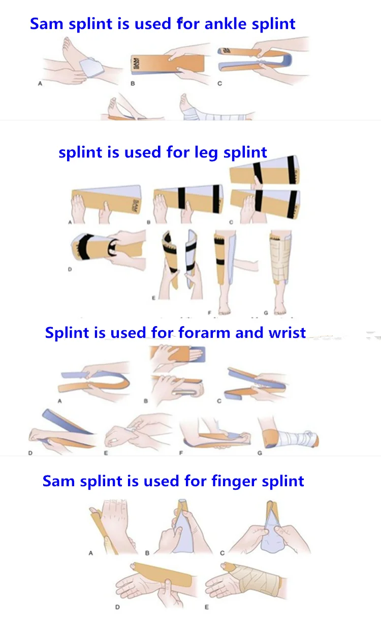Aluminum Alloy Medical Nasal Splint In Emergency - Buy Splints,Nasal ...