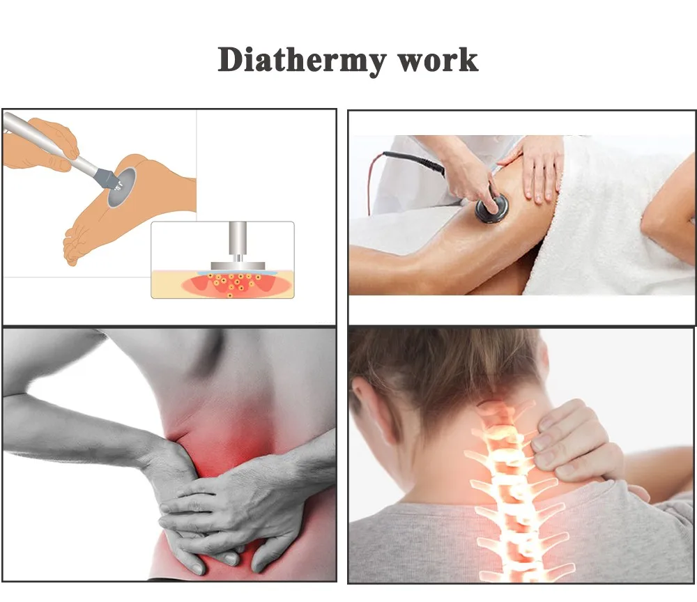 3 In 1 Therapia Diatermia Diathermy Ret Cet Rf Radiofrecuencia 448khz ...