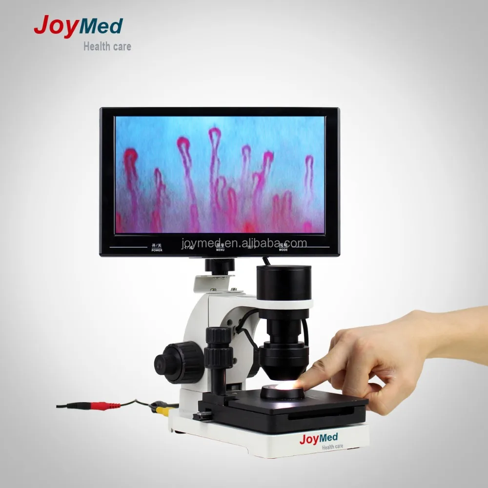 JOYMED Noninvasive Blood Capillary Microcirculation Microscope ...
