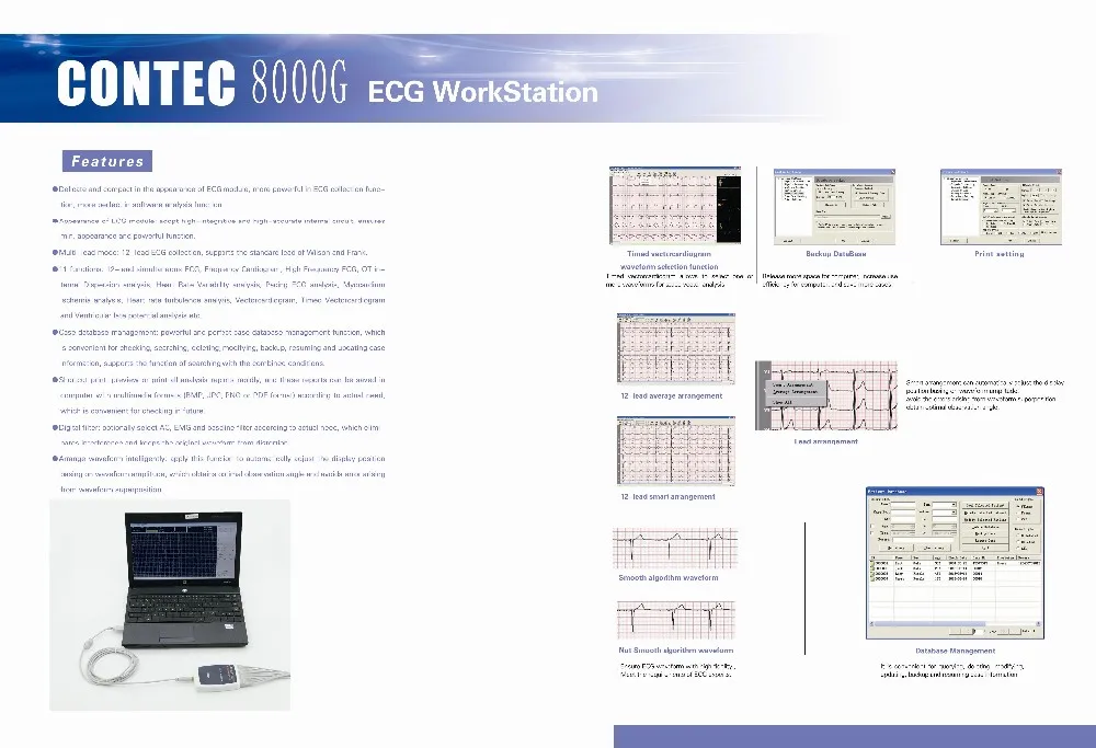 CONTEC8000G EKG Workstation - Reliable USB ECG Machine