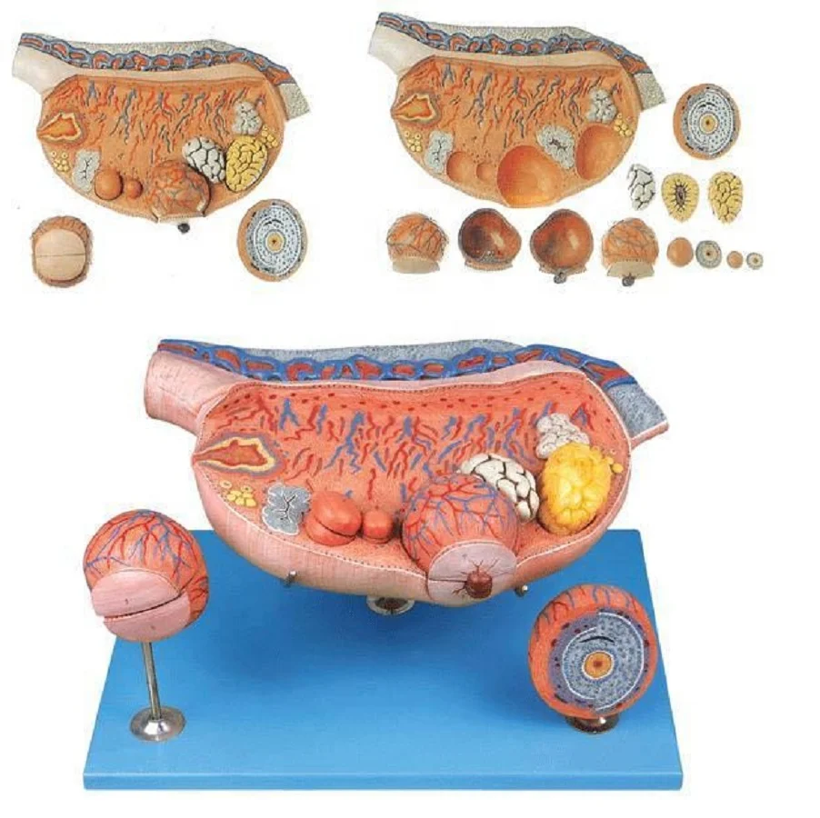 Ovary Model