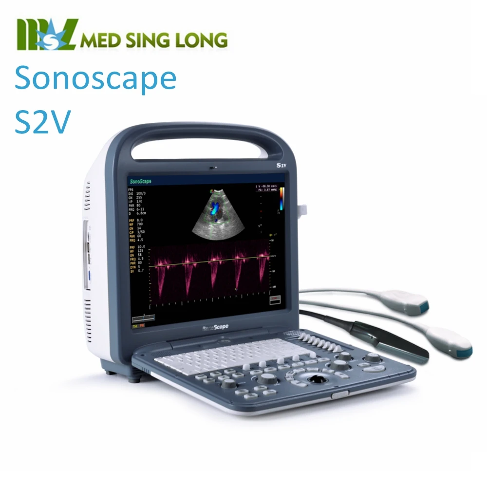 Alibaba.com: Sonoscape S2V Portable Color Doppler Veterinary Ultrasound ...