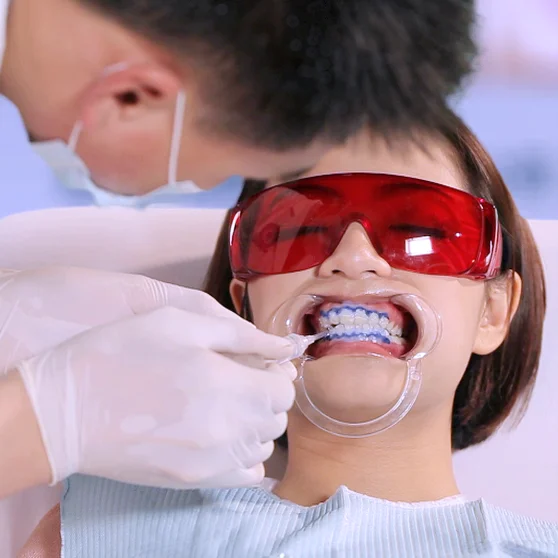 Dental Gingival Gel Dam Barrier Gum Protector Syringe Teeth Whitening ...