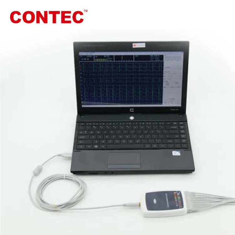 CE CONTEC8000G ECG Workstation - 12-Lead Analyzer, Portable ECG Device ...