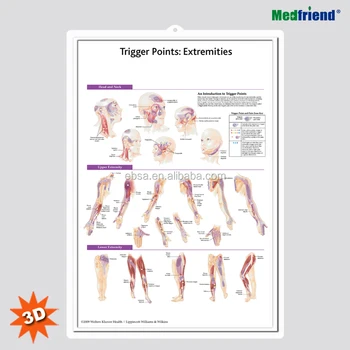 3d Medical Human Anatomy Wall Charts / Poster - Trigger Points ...