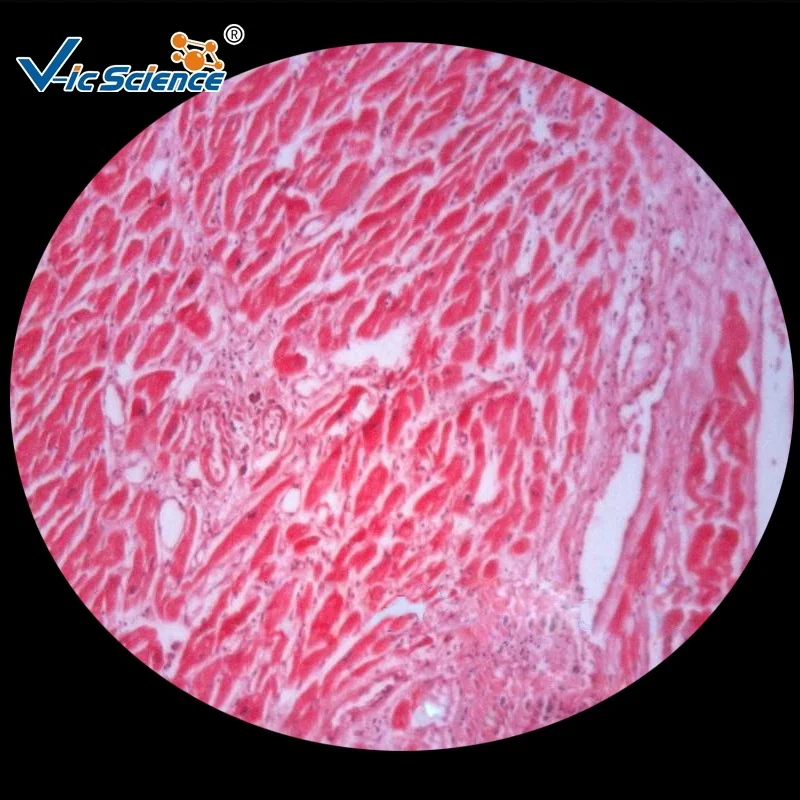 Microscope Slide of Pathology Disease Educational Slides