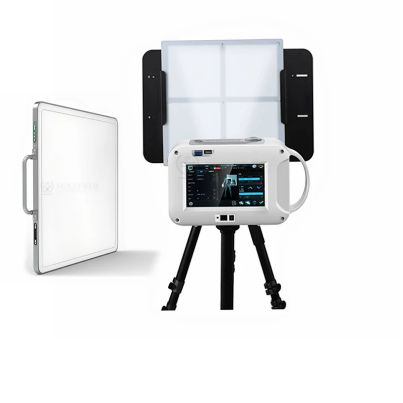 Lung Diagnosis with Portable X-Ray System - 70KV Chest X Ray