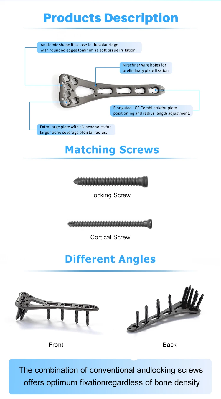 Osteosynthesis Material Orthopedic Volar Distal Radius Locking Plates ...