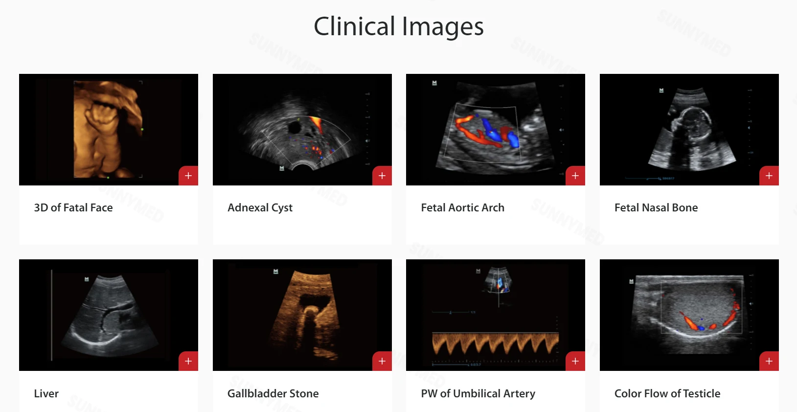 Mindray Z50 Ultrasound Scanner - Portable Color Doppler