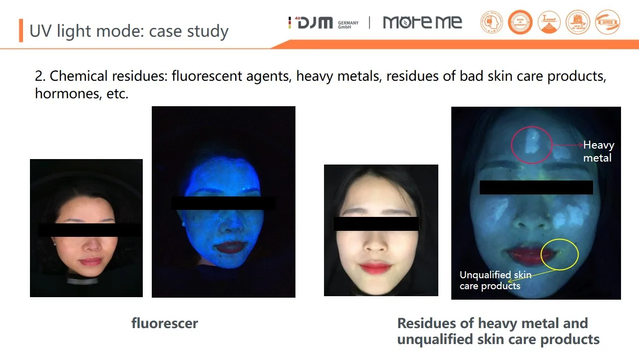 2023 Newest Skin Tester Professional Observe Diagnostic Scanner De ...