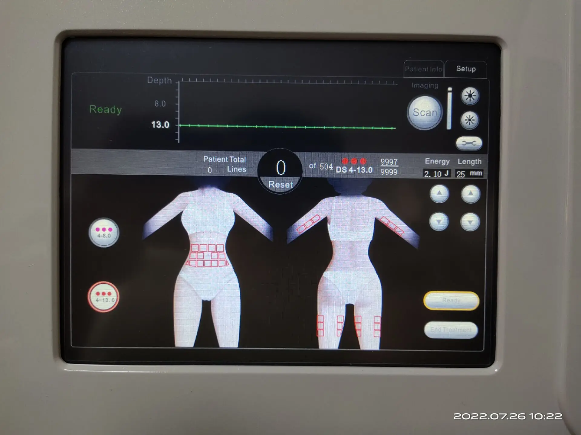 Portable Smas Skin Lifting Tightening Neck Lift Face Lifting Beauty ...