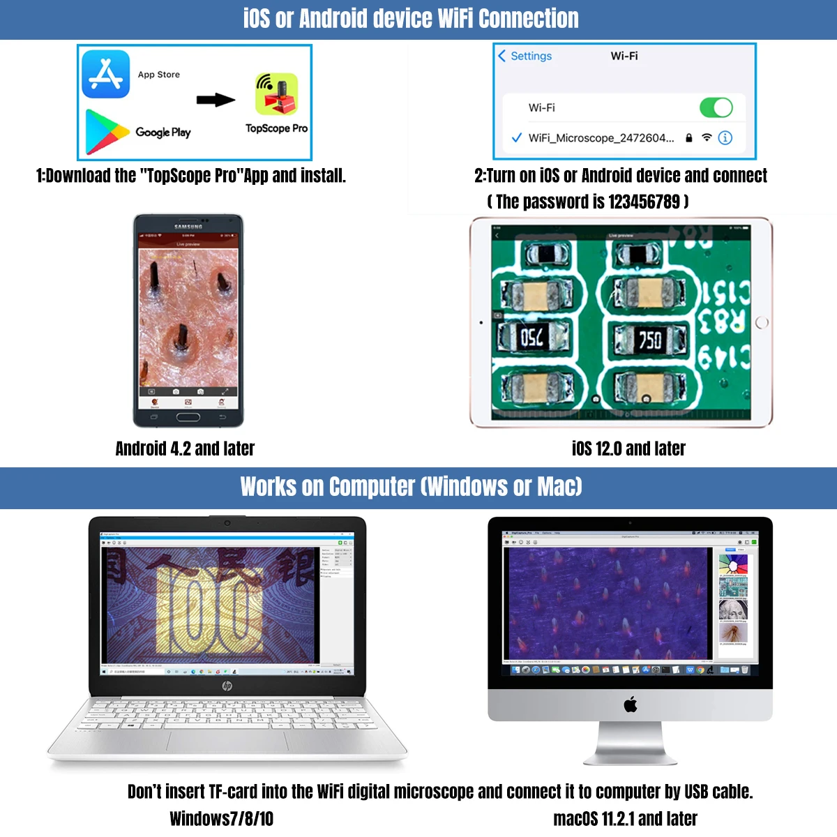 Uv Wifi Dermatoscope For Iphone With Capture Microtouch Dm023b - Buy ...