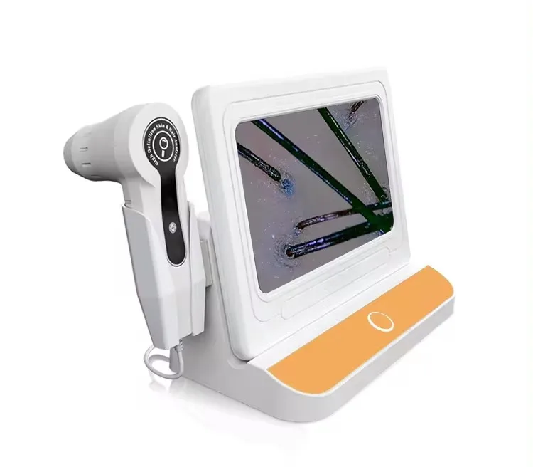 Hair Analyzer - Portable HD Scalp Scanner for Hair Follicles