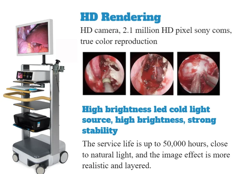 Surgical Equipment Urology Endoscope Catheter Camera System Cystoscopy ...