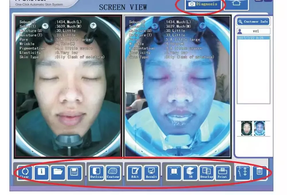 Professional Magic Mirror Face 3d Skin Digital Skin Analyzer Face ...