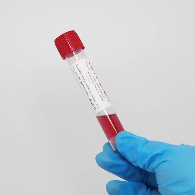 10 Ml Disposable Transport Medium Kit Virus Sampling Tube - Buy 10ml ...