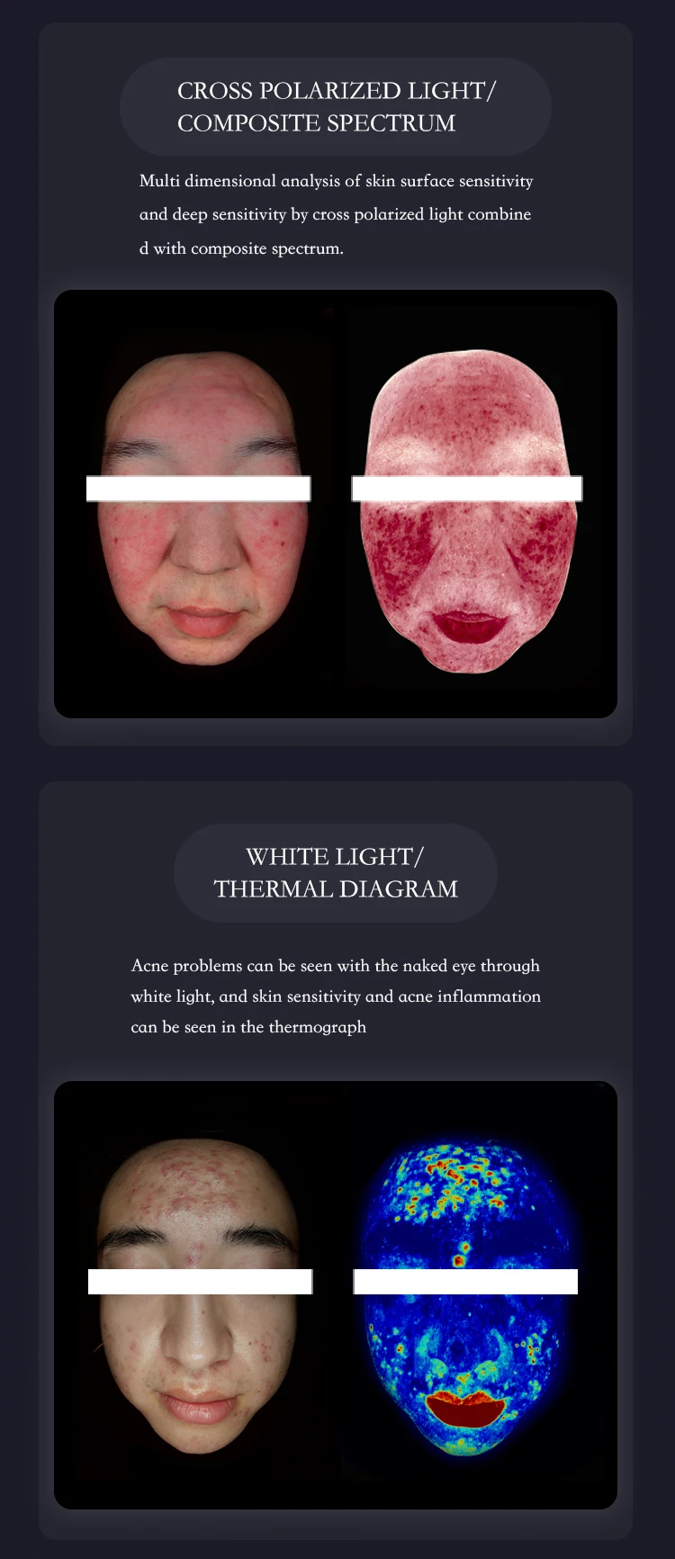 2024 New Skin Analysis Machine Facial Skin Detection Machine Magic ...