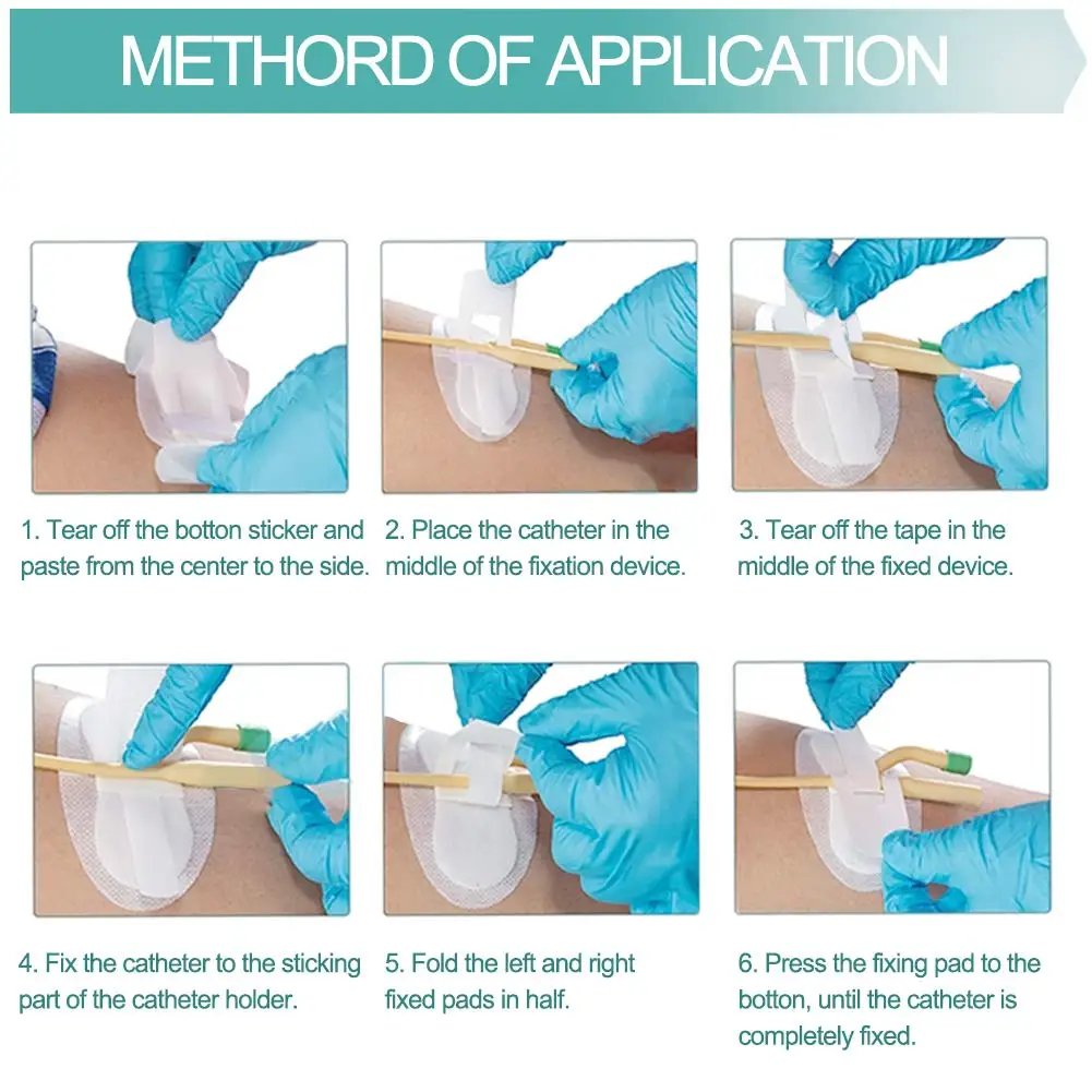 Medical Catheter Fixator Urinary Duct and Bile Duct Fixation Device ...