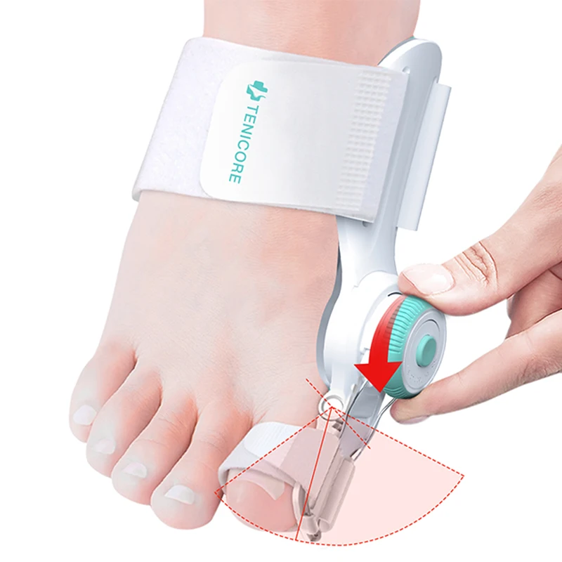 99insole Day & Night Bunion Hallux Valgus Corrector Orthopedic Bunion ...
