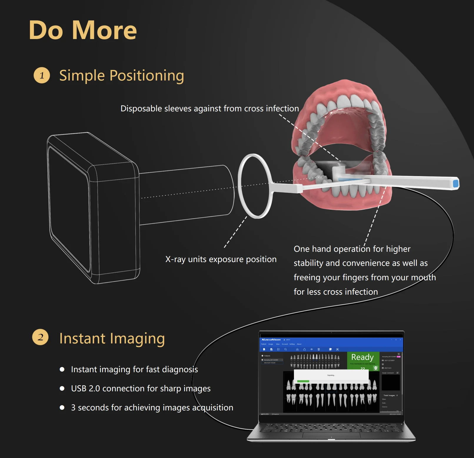 Rvg Digital Oral X-ray Sensor Oral Imaging System Dental X-ray Sensor ...
