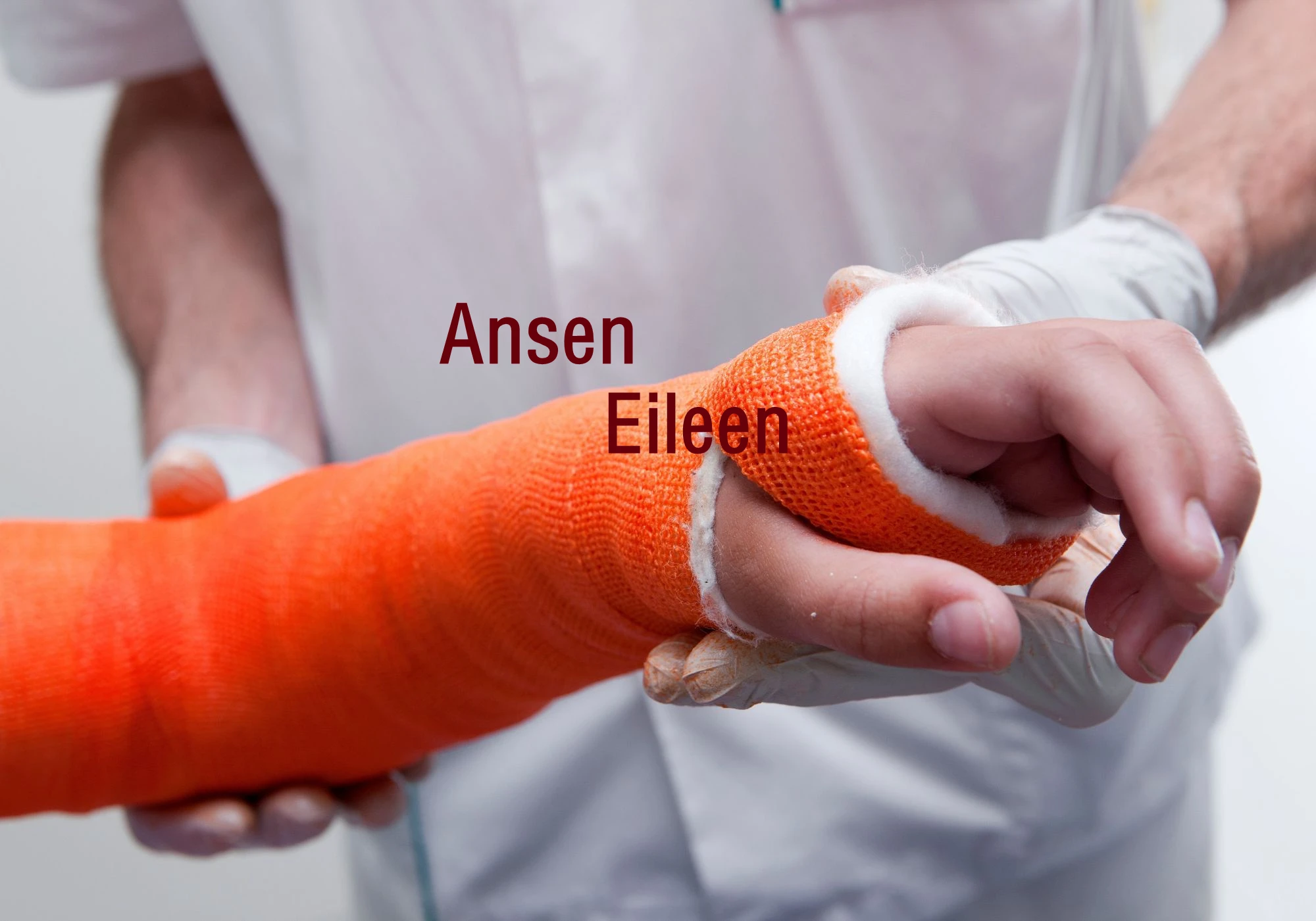 Medical Synthetic Fiberglass Orthopedic Plaster Cast Durable Material ...