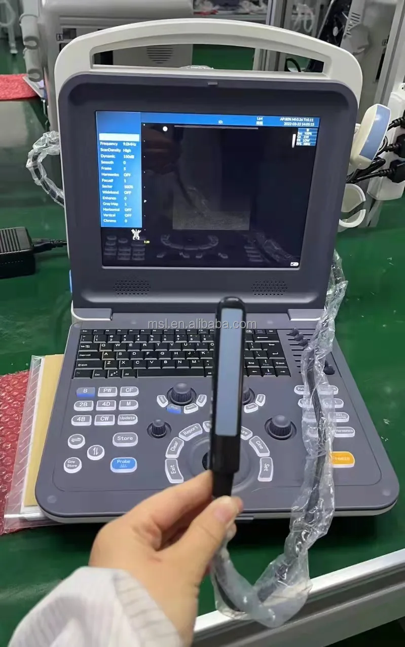 Veterinary Ultrasound Scanner V8 - Portable & Affordable