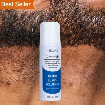 Razor Bump And Ingrown Hairs Serum Aftershave For Men Razor Bump ...