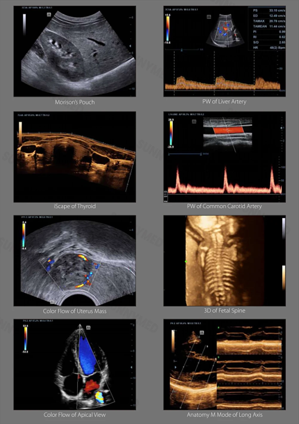 Mindray DC-40 Portable Ultrasound - Advanced Diagnostics