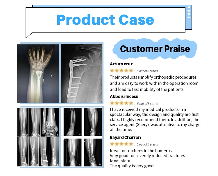 Osteosynthesis Material Orthopedic Volar Distal Radius Locking Plates ...