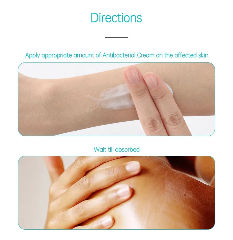 Skin Pruritus Ointment Skin Ringworm Wang Ointment Dispel Psoriasis ...