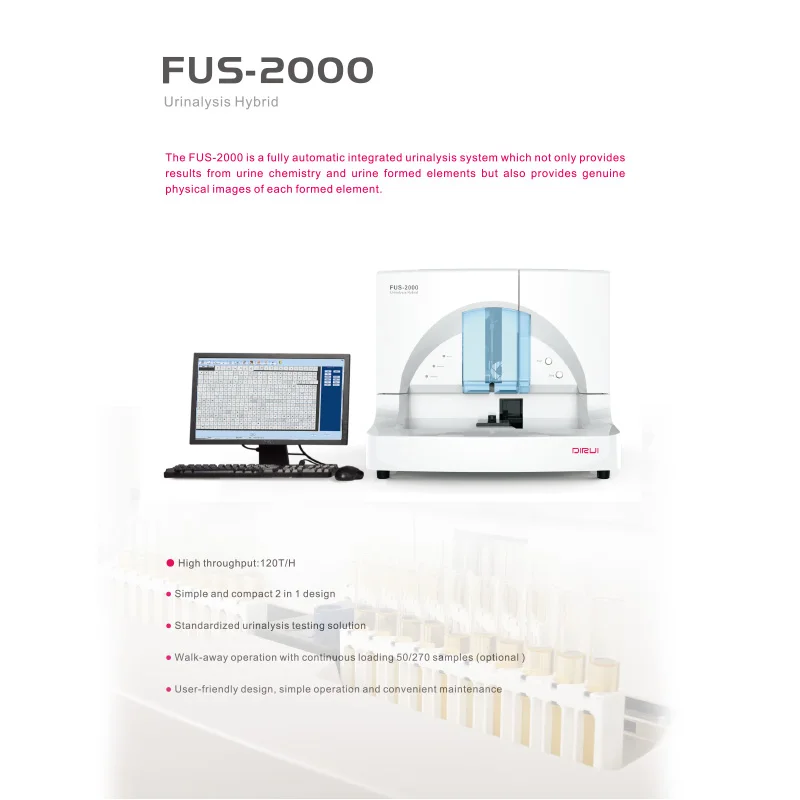 Fus-2000 Fully Automatic Integrated Urinalysis System Urine Analyzer ...