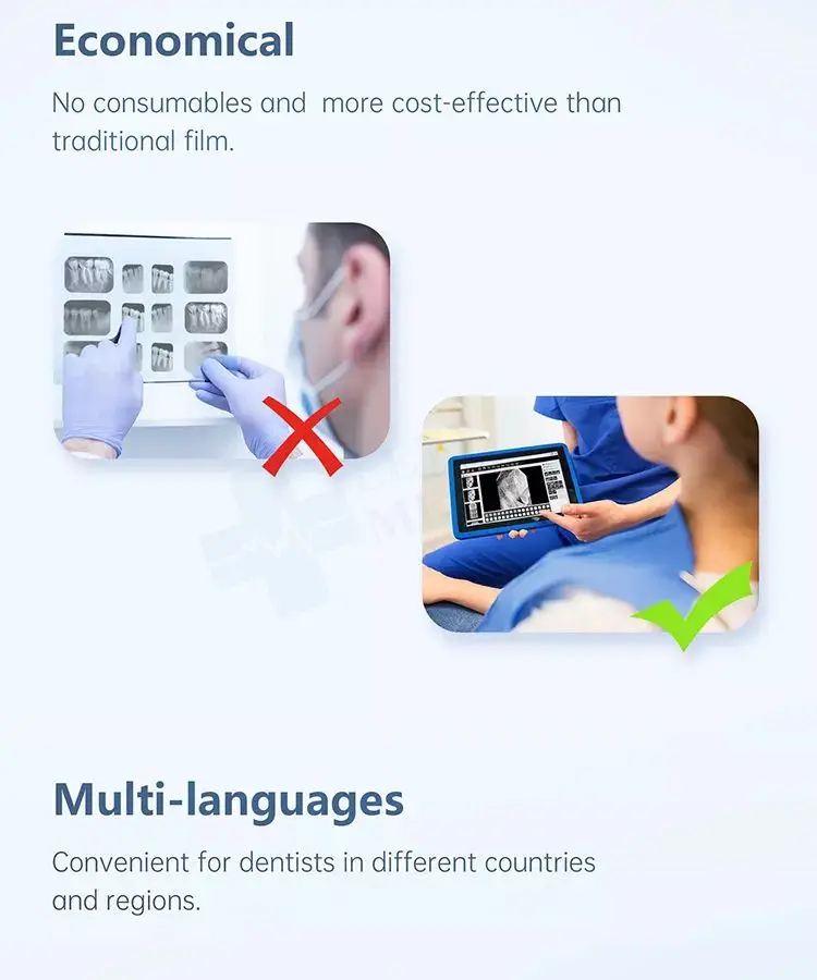 Cheapest Dental Sensor Digital Dental X-ray Image System With Software ...