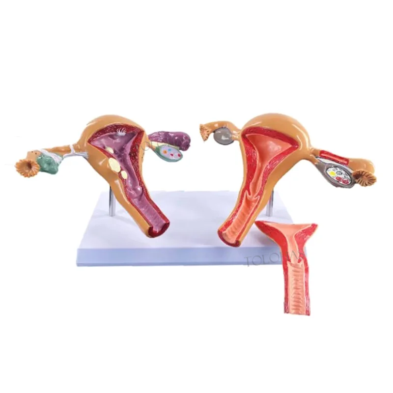LHN035A Medical Science Anatomy Uterus Model for Teaching Research ...