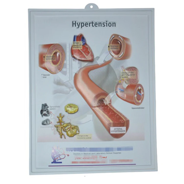 Custom Printing 3D Embossed Human Anatomy Poster - PVC Educational ...