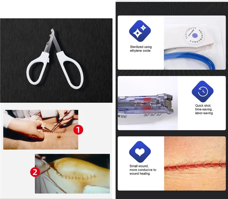 Surgical Skin Stapler And Remover 35w Sterile Disposable Skin Stapler ...