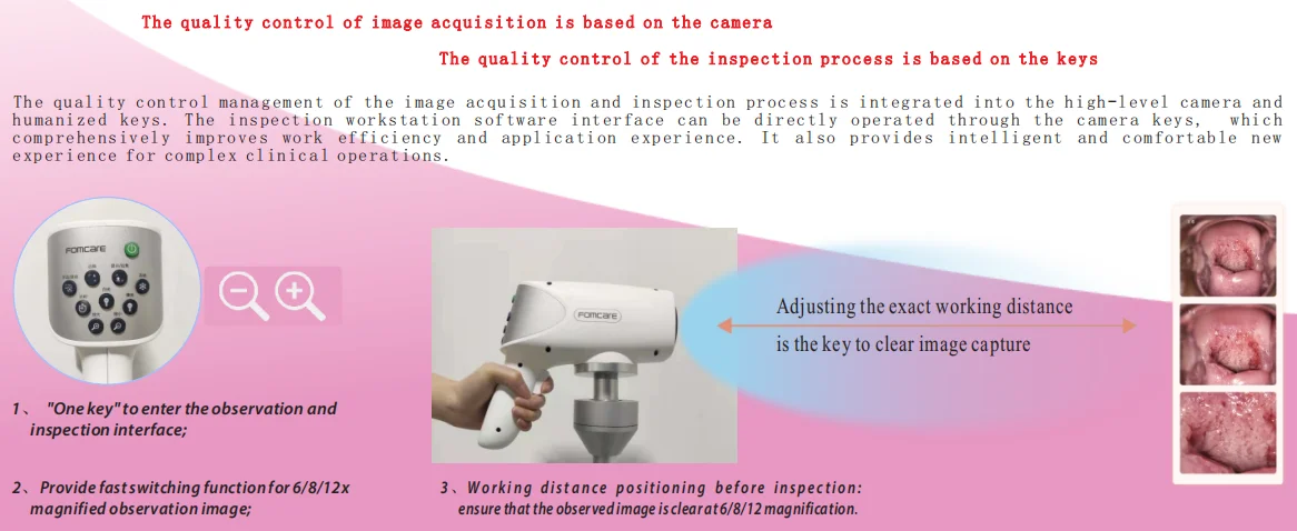 Vagina Video Digital Optical Colposcope System - Full Set