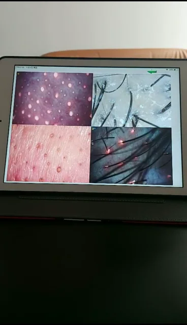 Portable Double Spectrum Skin And Scalp Camera Uv Skin And Scalp Hair ...