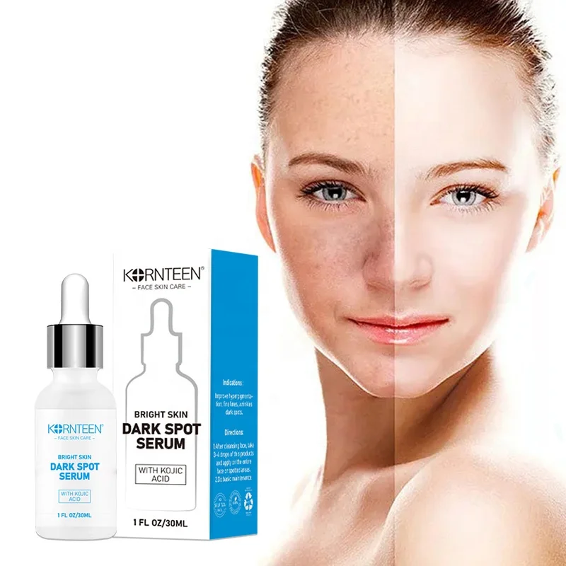 Acid Spots On Skin | atelier-yuwa.ciao.jp