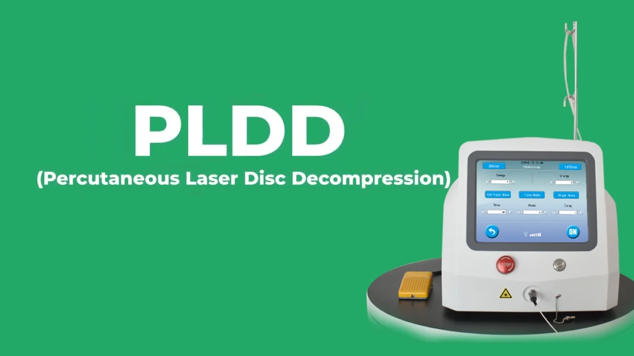Triangelmed Medical Disc Herniation Machine Treatment Disc Herniation Pldd Equipment Diode Laser ...