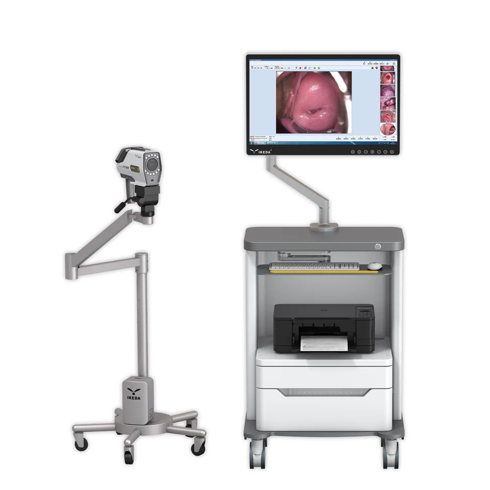 Full Hd Colposcope Camera For Vagina Colposcopy - Buy Colposcope Camera ...