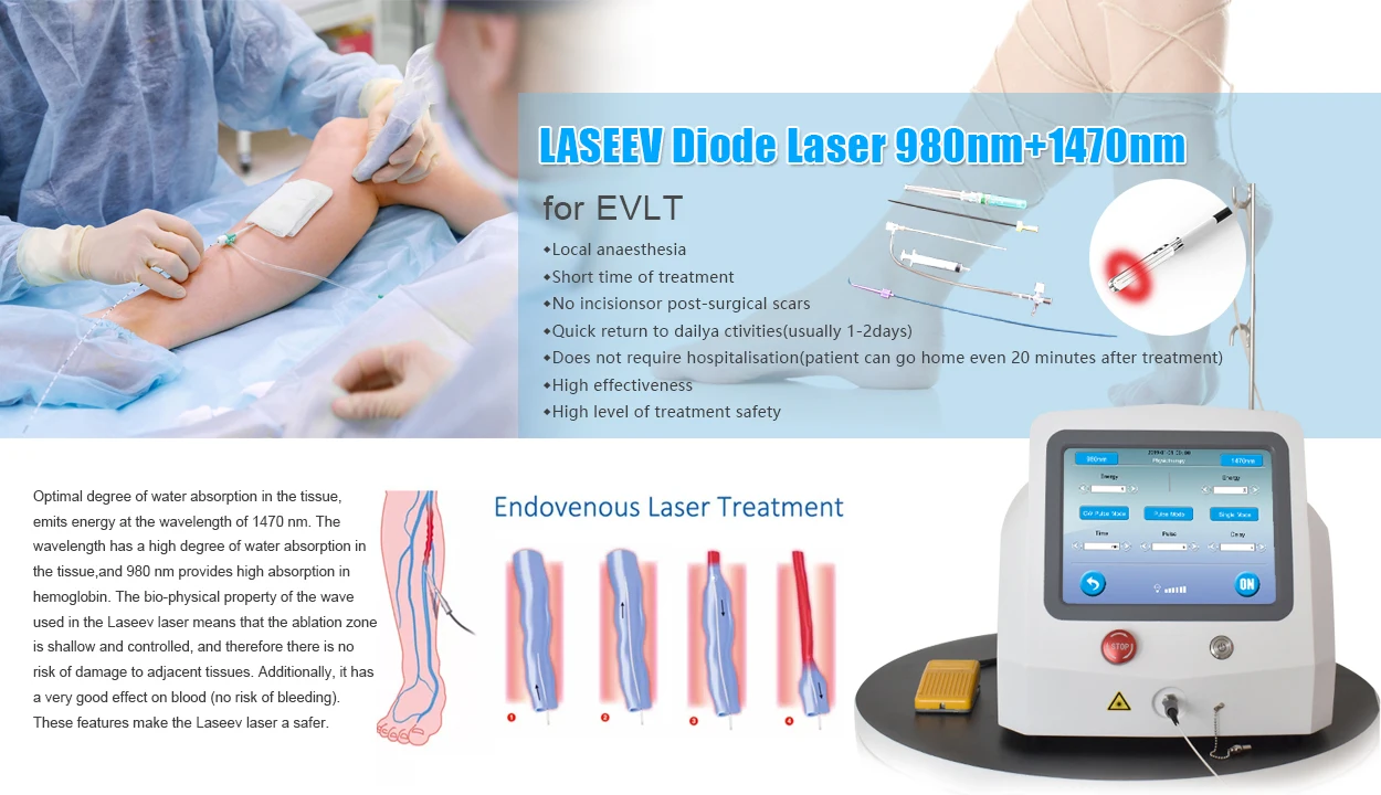Triangelmed Evlt/evla Laser Spider Vein Removal 980nm 1470nm For ...
