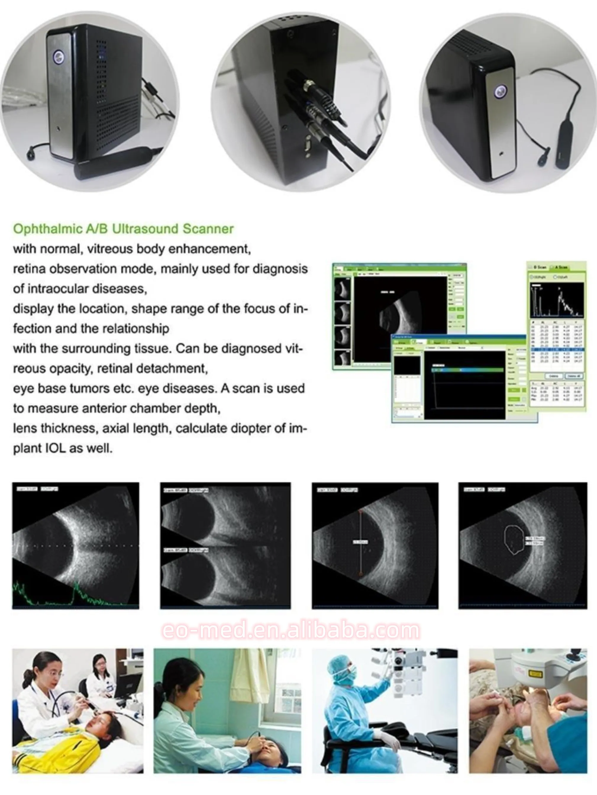 EOMED EUS500T - Portable Ophthalmic Scan Box for Sale