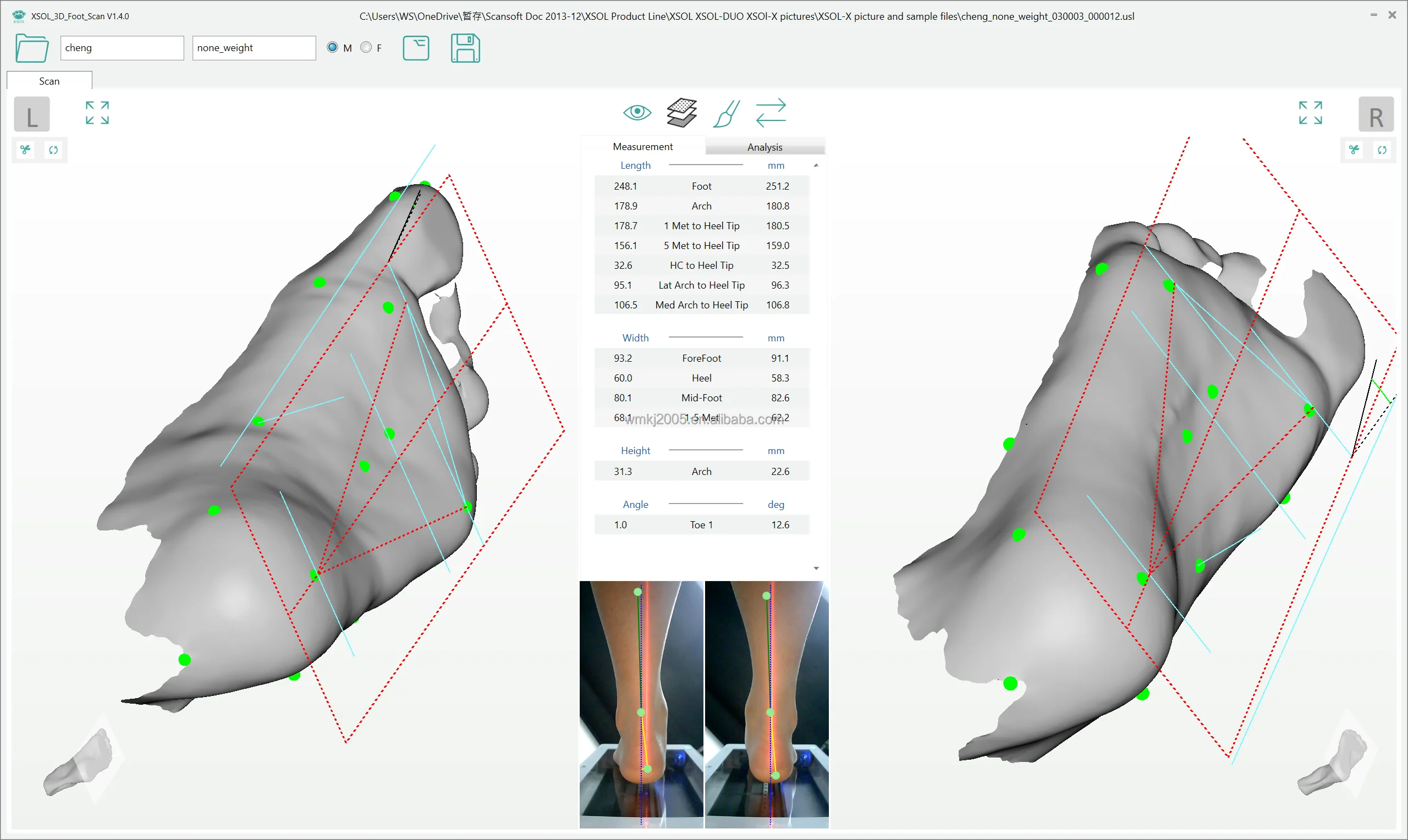 XSOL-X Custom Diabetic/orthotic Insoles - 3D Printed Support