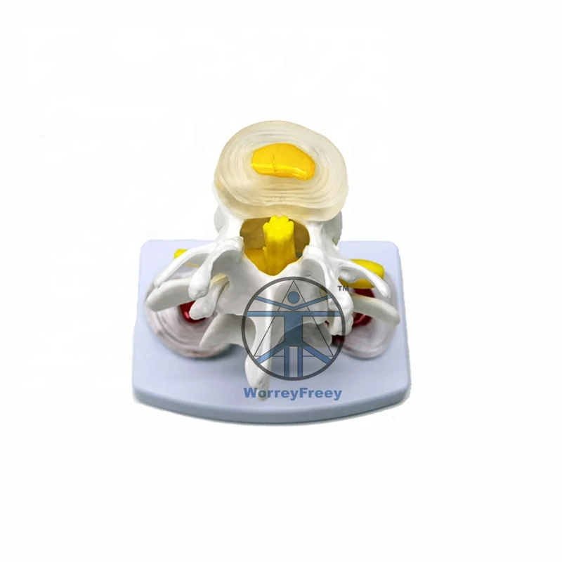 Medical Spine Endoscope Endoscopic Spine Surgery Teaching Model ...