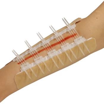 Bluenjoy Sterile Skin Color Wound Closure Device First Aid Wound Care ...