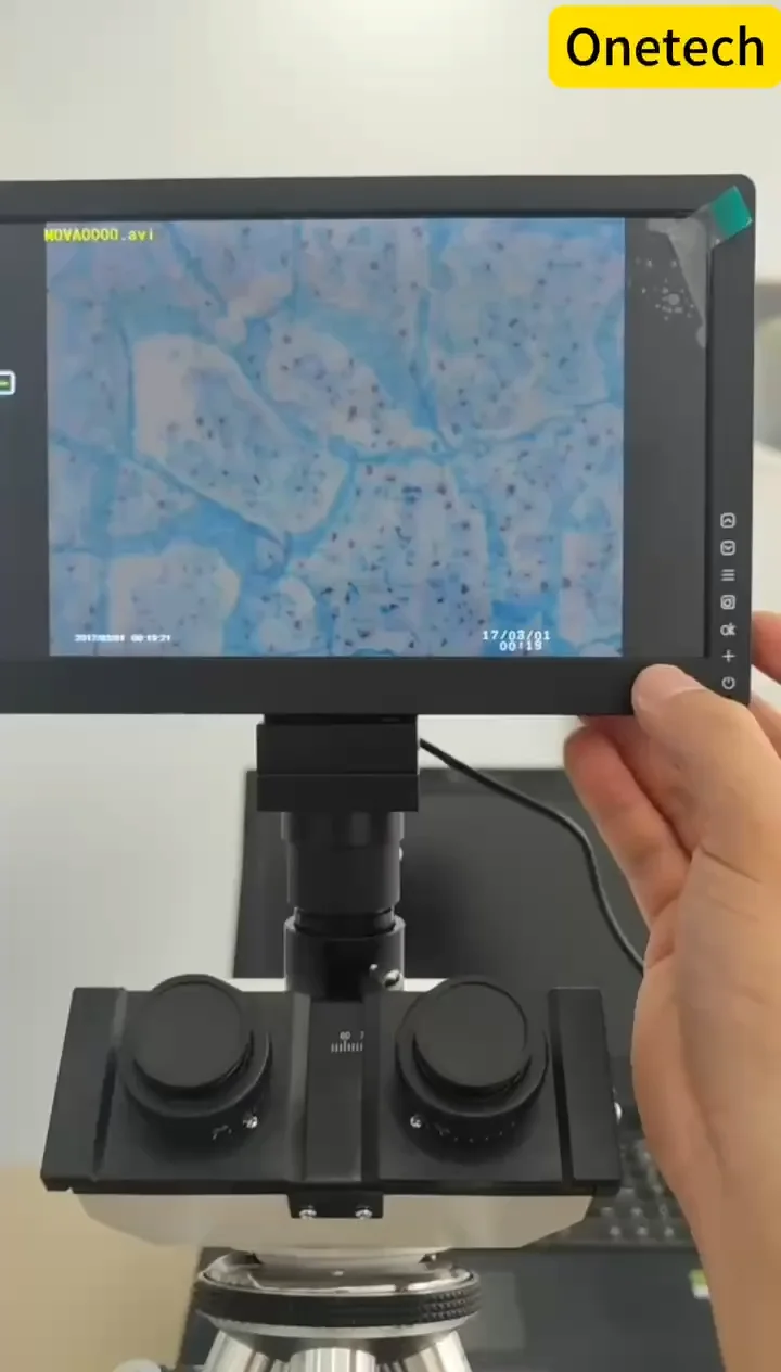 Ms110 High Resolution Portable Trinocular Laboratory Microscope With 9 ...