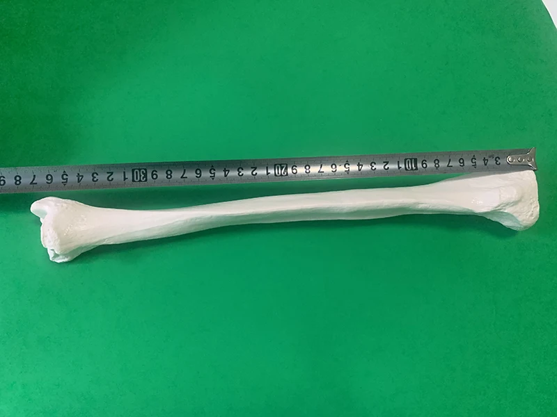 Radius Model Human Bone Model Medical Skeleton Model - Buy Bone Model ...