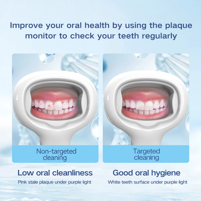 Plaque Detector Custom Logo Home Dental Care Whitening Tool Handheld ...